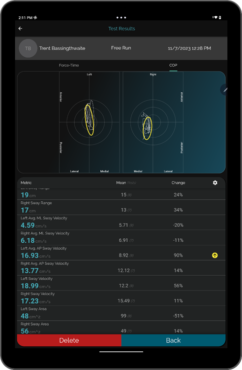 Center of Pressure (COP): Everything you need to know and how to ...
